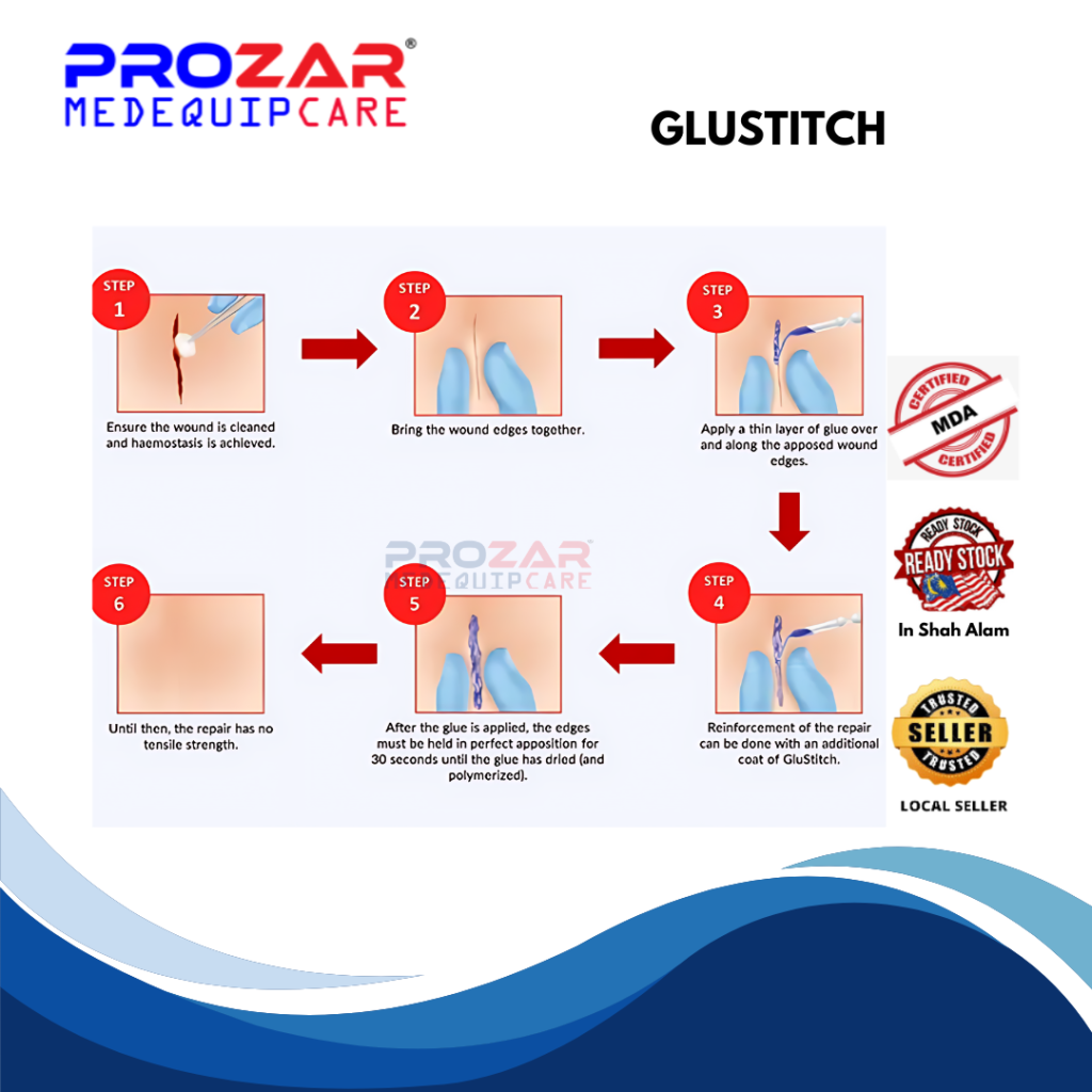 GLUSTITCH® 0.2ML - PROZAR MEDEQUIPCARE GluStitch®